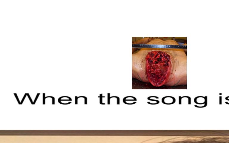 Pinkiepie Hate Club ― Perchance Generator